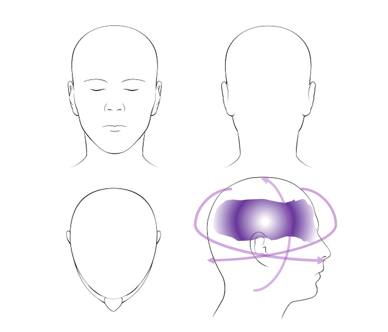 BPPV Physiotutoren