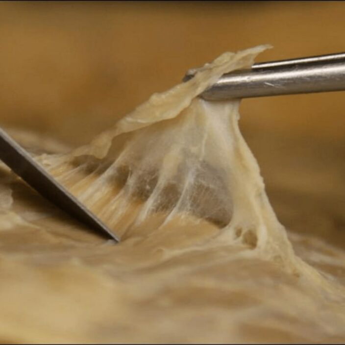 Management of Plantar Heel Pain - Everything you need to know!
