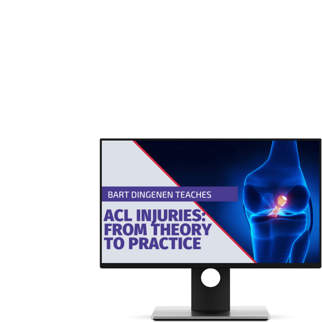 Hop Test Cluster by Gustavsson | ACL Return to Play Testing