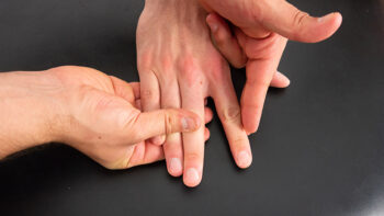 Myotomen bovenste ledematen Perifeer neurologisch onderzoek