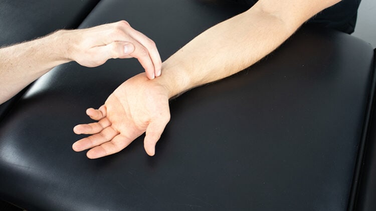 Tinel Sign of the Wrist | Carpal Tunnel Syndrome Assessment