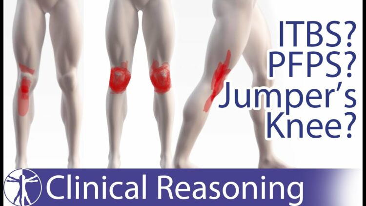 Atraumatic Knee Pain Differential Diagnosis | ITBS, PFPS, Jumper's Knee