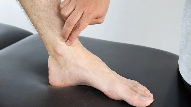 Tinel Sign Ankle | Nerve Entrapment | Tarsal Tunnel Syndrome