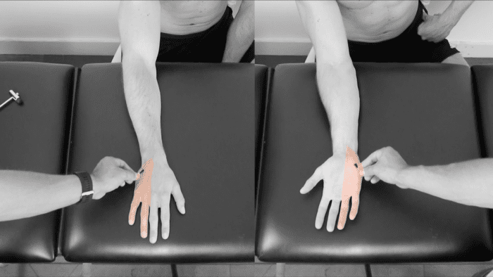 Dermatomes Upper Limb | Peripheral Neurological Examination