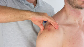 Paxinos Sign | Acromioclavicular Joint Pathology Assessment