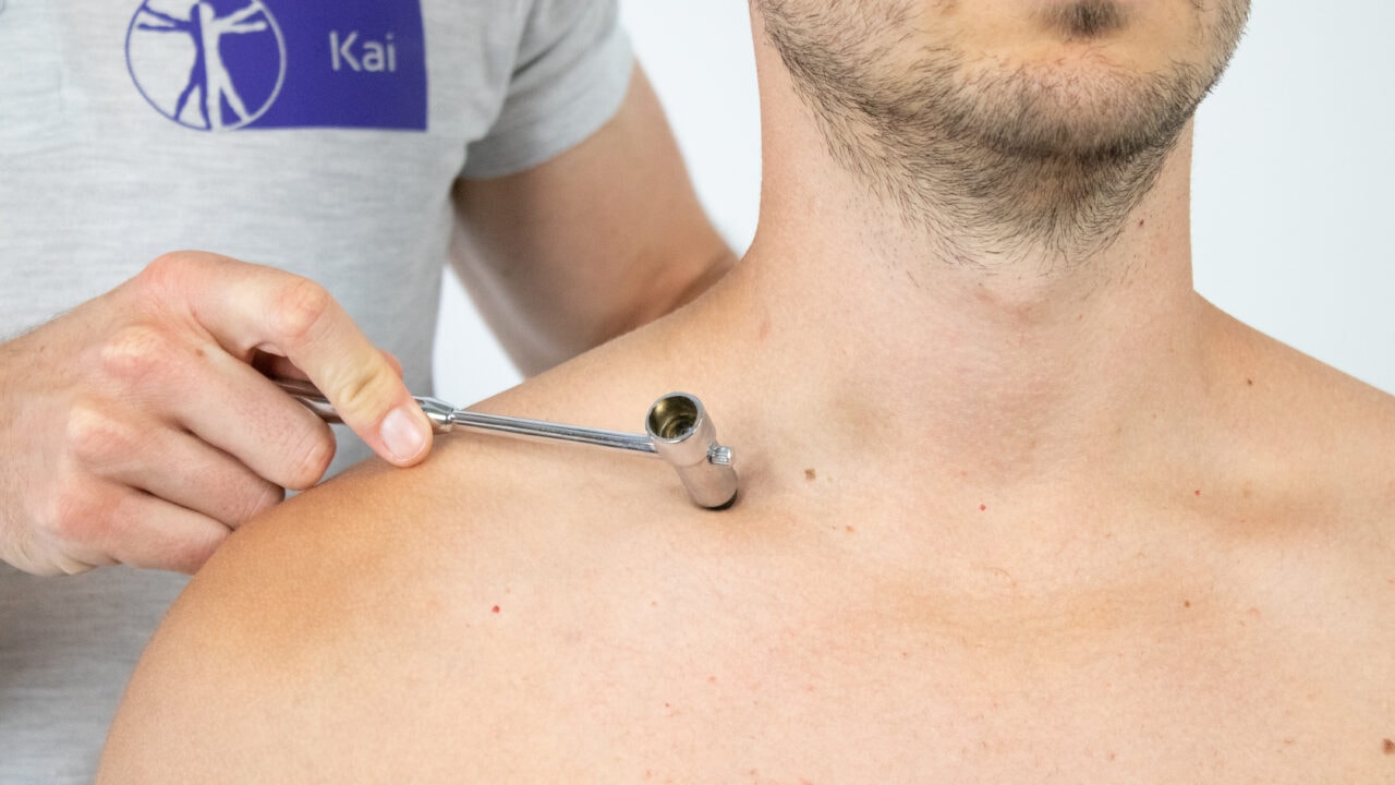 Tinel Sign for TOS | Thoracic Outlet Syndrome Assessment