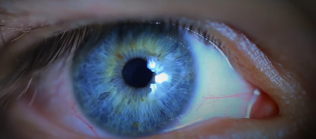 Oculomotor Nerve | Cranial Nerve III / CN III Assessment