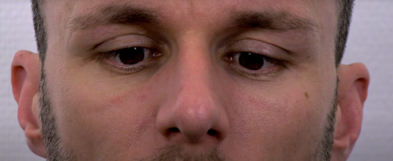 Trochlear Nerve | Cranial Nerve IV / CN IV Assessment