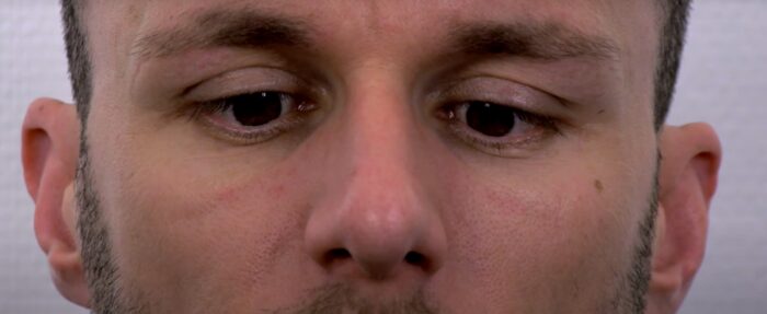 Trochlear Nerve | Cranial Nerve IV / CN IV Assessment