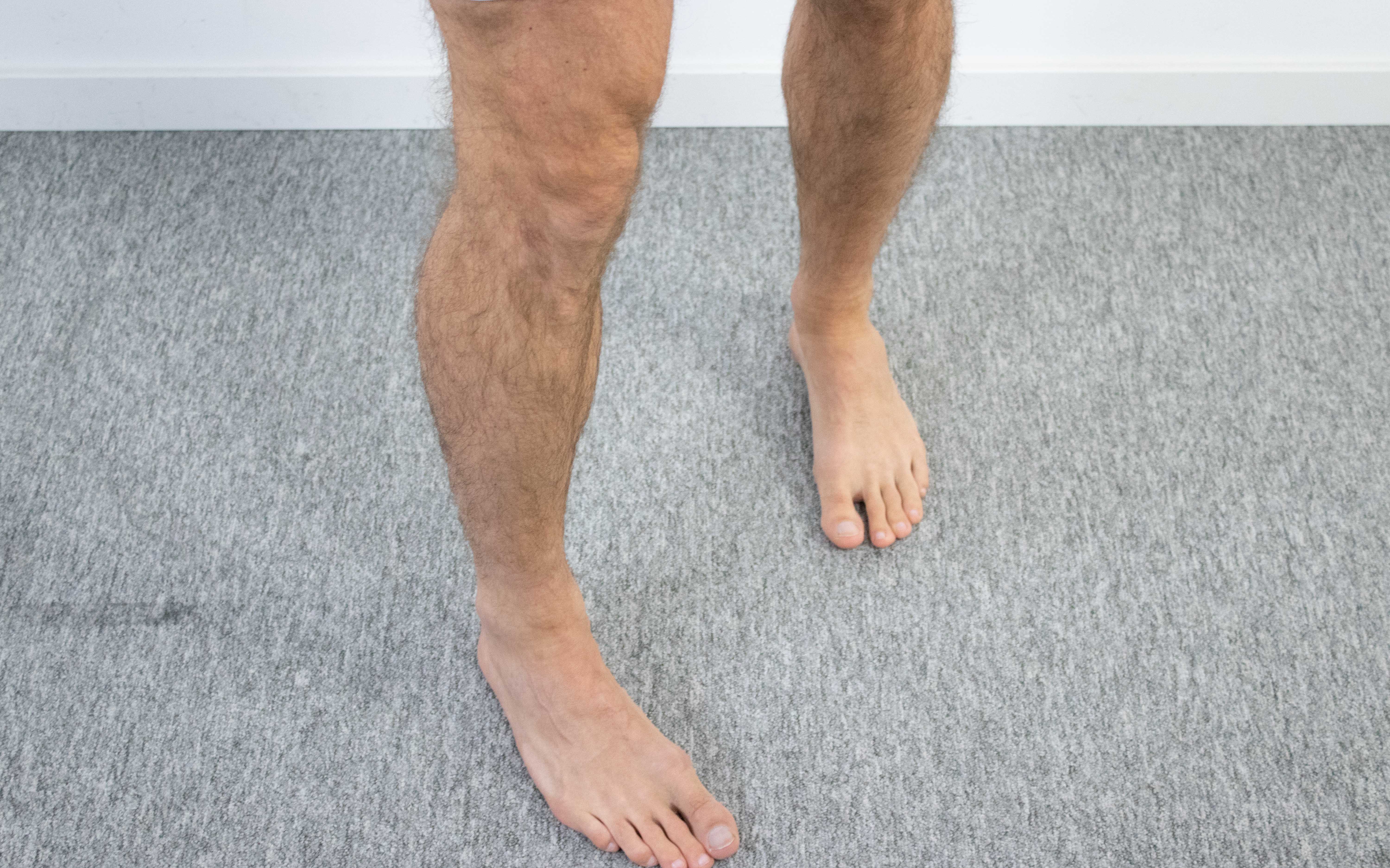 Foot Progression Angle Walking Test - Physiotutors