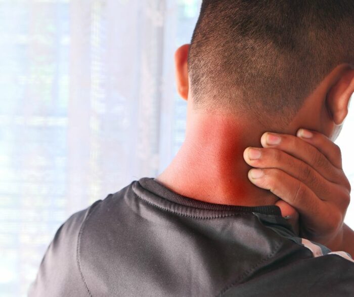 Physiotherapy for Neck Pain | Assessment & Treatment