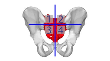 Sacroiliac Joint Counternutation | SIJ Dysfunction Assessment