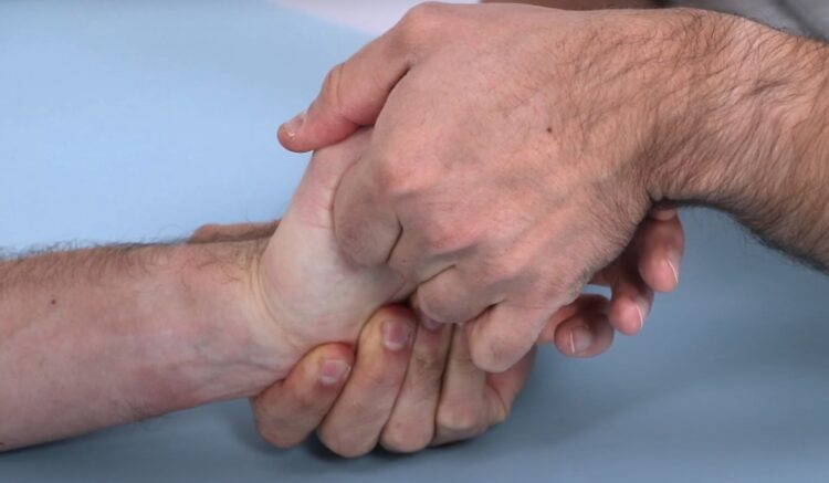 Test de flexion MC | Arthrose carpométacarpienne | Arthrose du pouce
