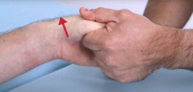 Traction-Shift Test / Subluxation Relocation Test | Thumb CMC1 OA