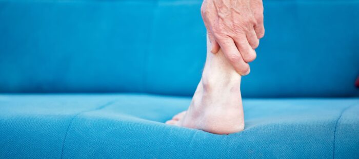 Progressing Achilles tendon loads during rehabilitation | Research