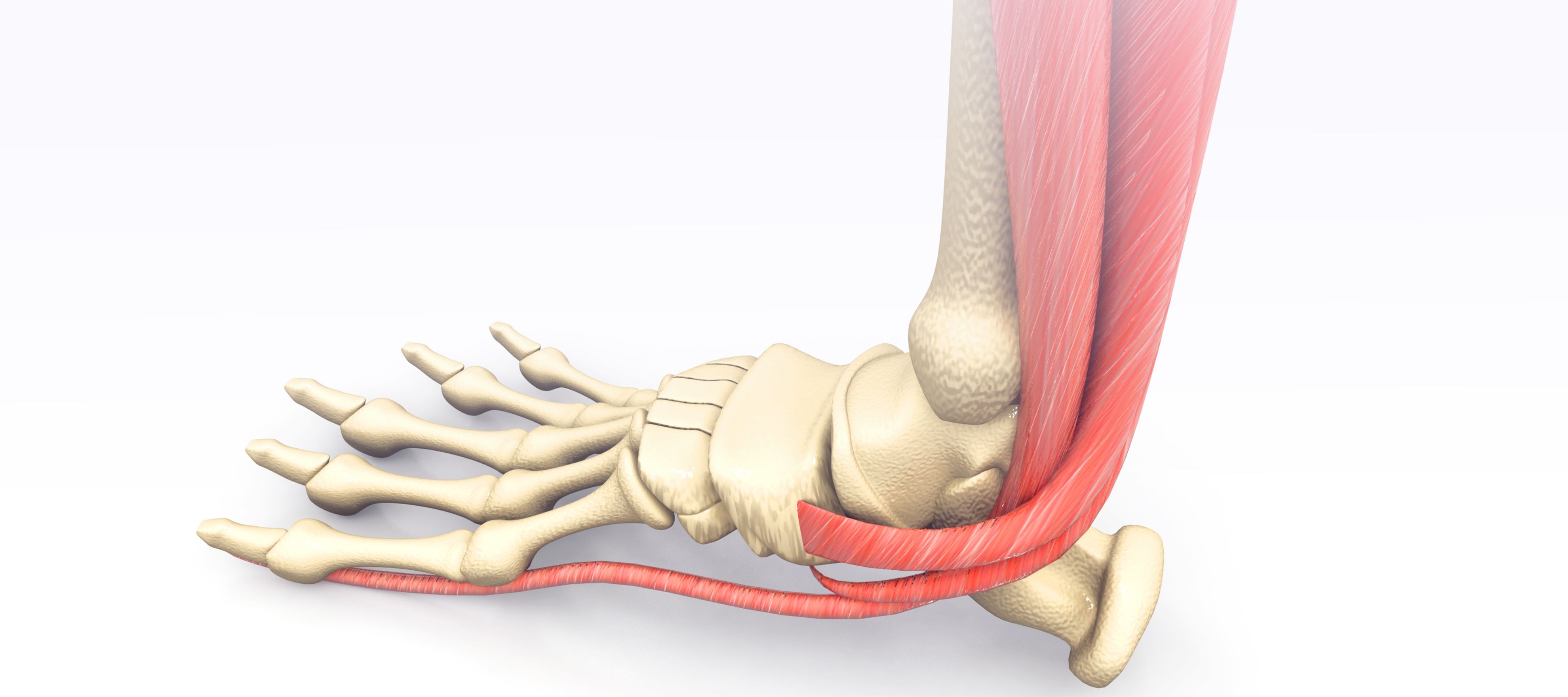 Posterior Tibial Tendon Dysfunction in Runners | 1h Masterclass