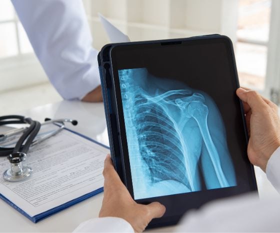 Rehabilitation for Anterior Shoulder Dislocation - Physiotutors