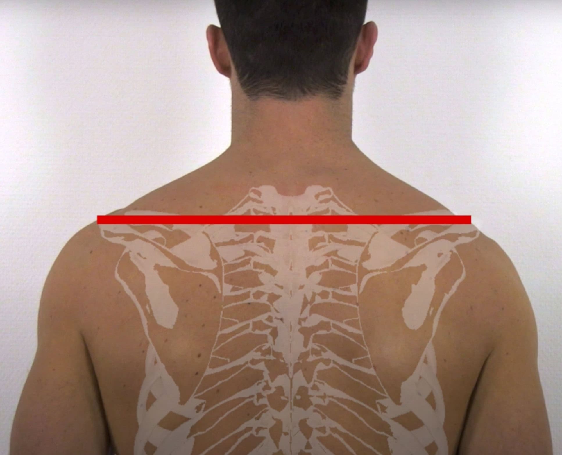 Scapular Alignment - Physiotutors