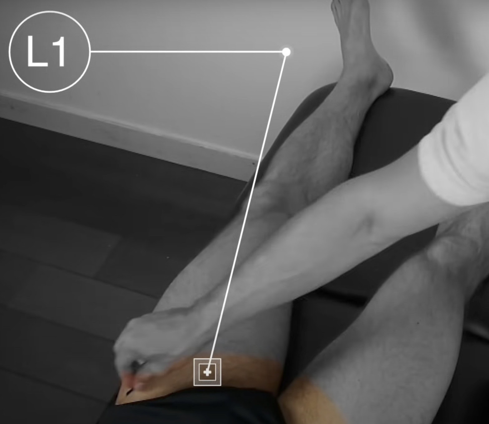 Deramtome testing L1 - Physiotutors