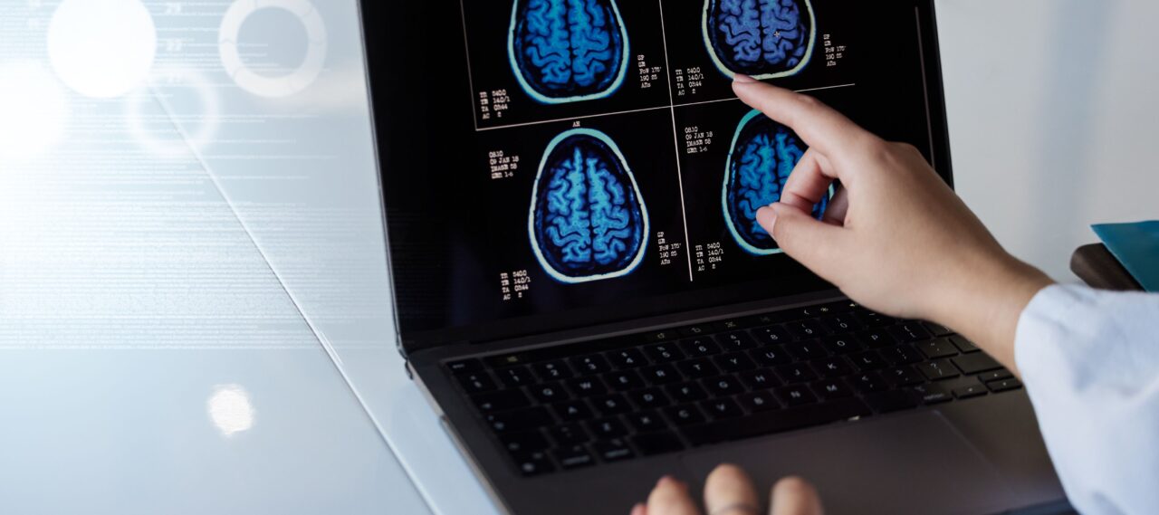 Pain Neuroscience Education: Structural Brain Changes - Physiotutors