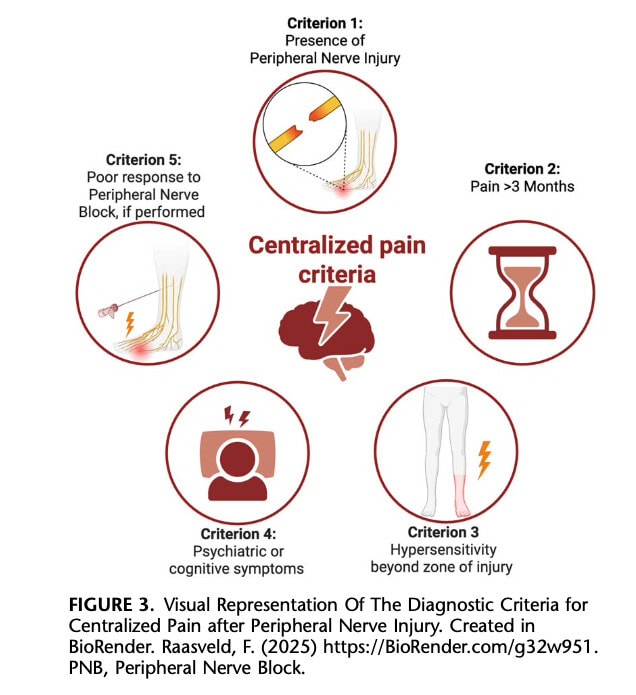Centralized pain following nerve injury, new diagnostic criteria ...